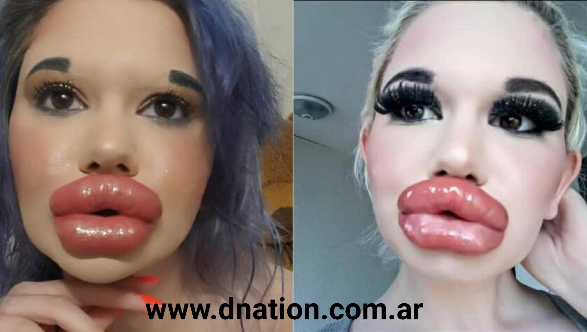 Tiene los labios más grandes del mundo y sus fanáticos se preocupan ...